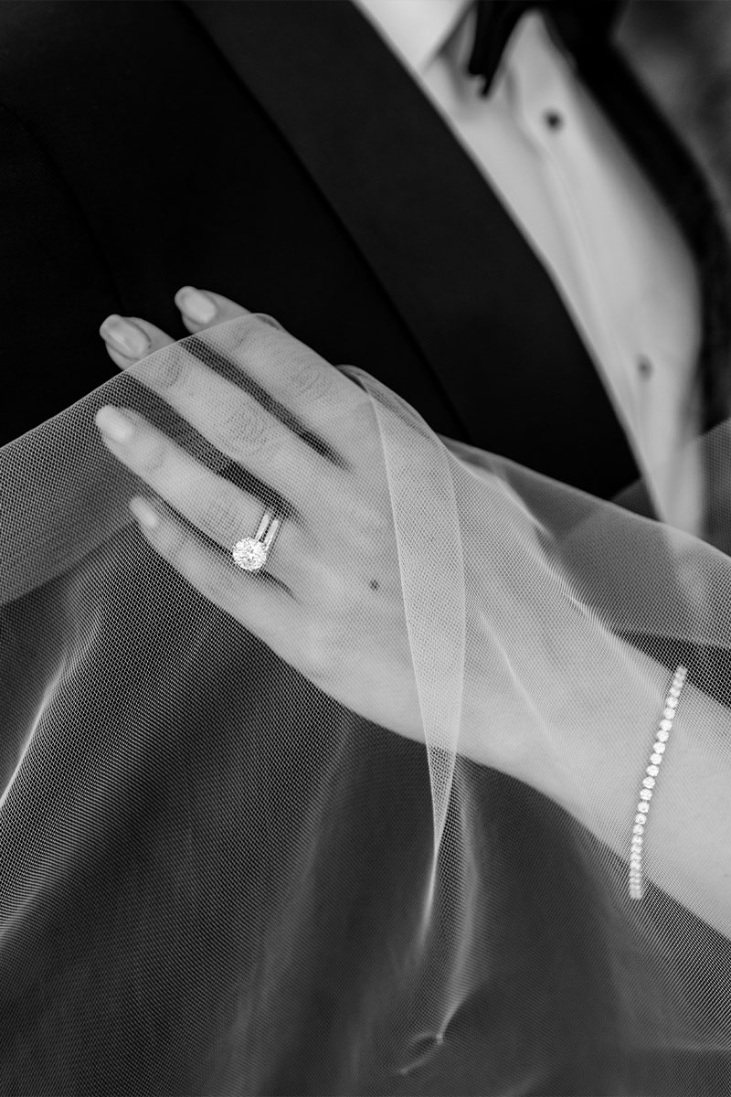 Wedding Ready Skin Guide | XO Aesthetics in Shelby Township, MI